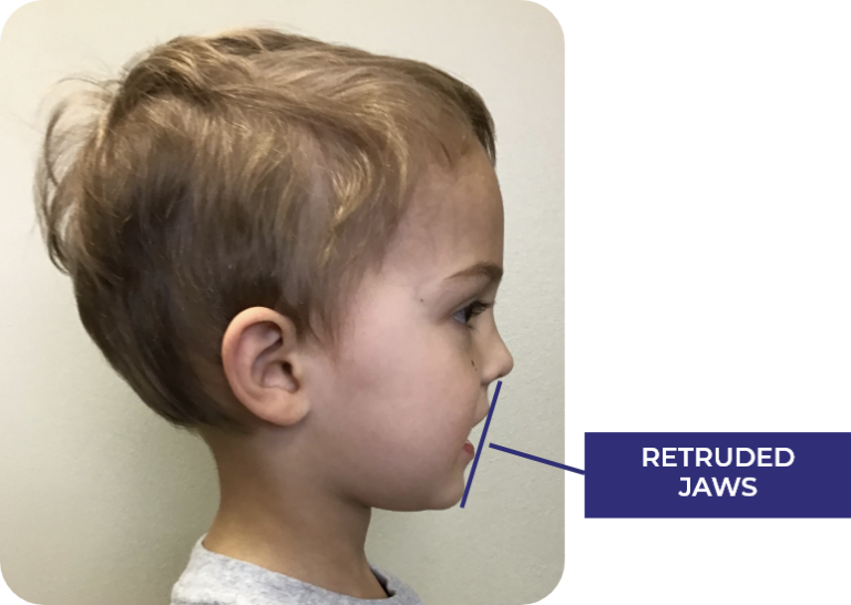 Orthotropics® - Root Cause Dentistry